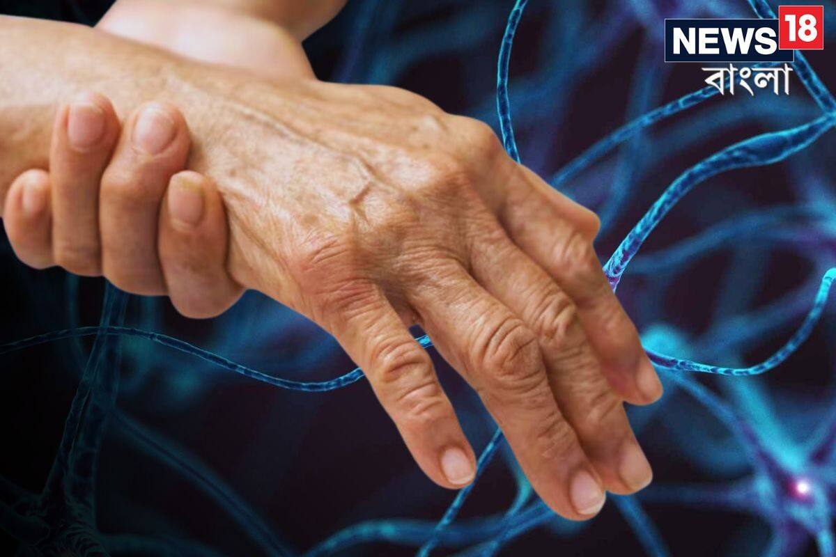 Guillain Barre Syndrome গুলেইন বারি সিনড্রোম সন্দেহে মৃত্যু রাজ্যের! বারাসতে মৃত্যু হল ছাত্রের ...