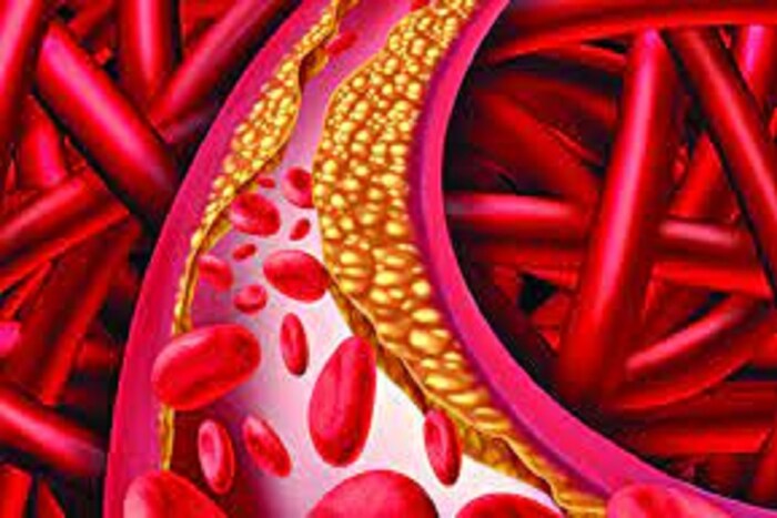 High Cholesterol Control Tips একটি সবজির রসেই কুপোকাত খারাপ কোলেস্টেরল