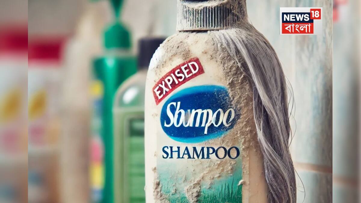 Expired Shampoo Skin Effects: মাথার ত্বকে বারবার চুলকানির সমস্যায় ...