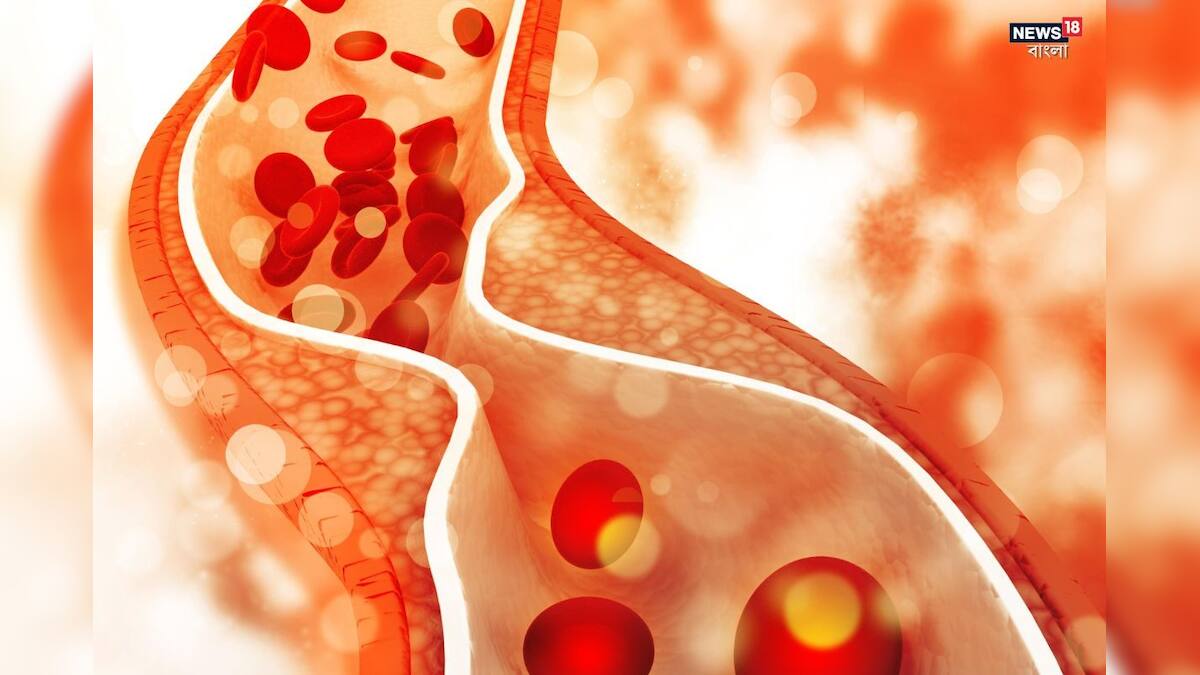 cholesterol control tips 5 black foods to control high cholesterol ...