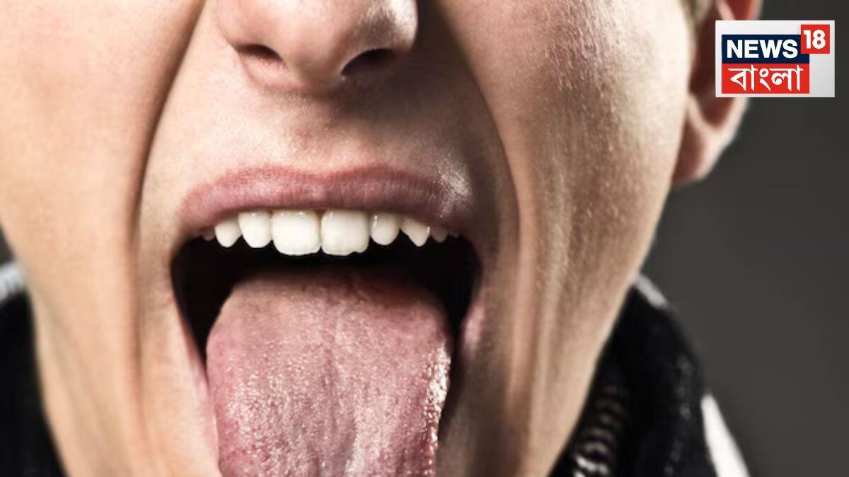 Bad Mouth Smell: মুখ দিয়ে বোটকা গন্ধ আসছে! আপনার মুখের এই জিনিসে ময়লা ...