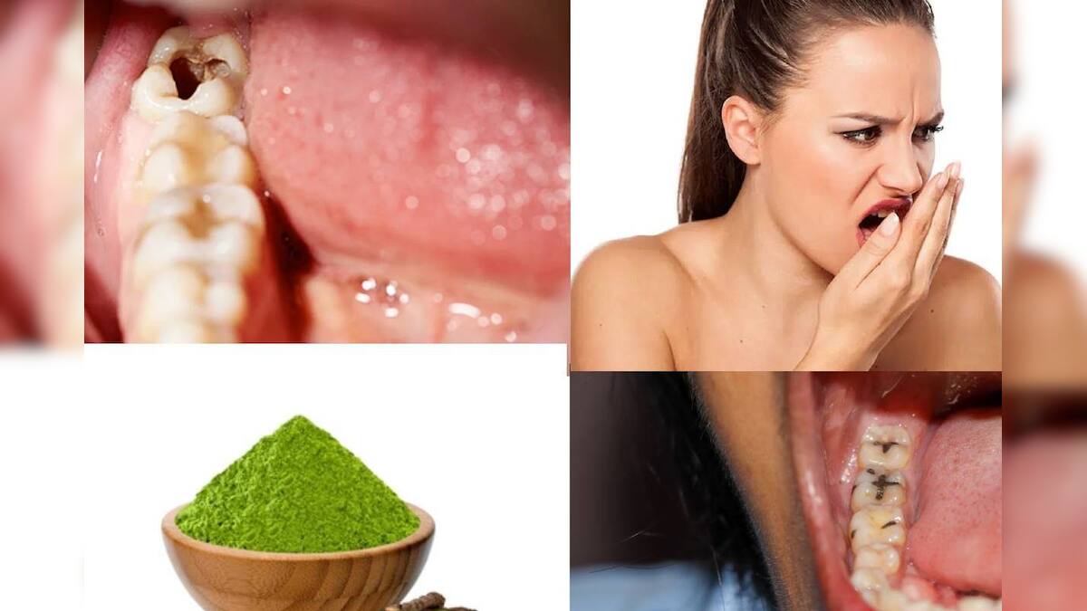 Teeth Cavity: দাঁতের পোকায় কুরে কুরে বাড়ছে কালো গর্ত? মুখের পচা ...