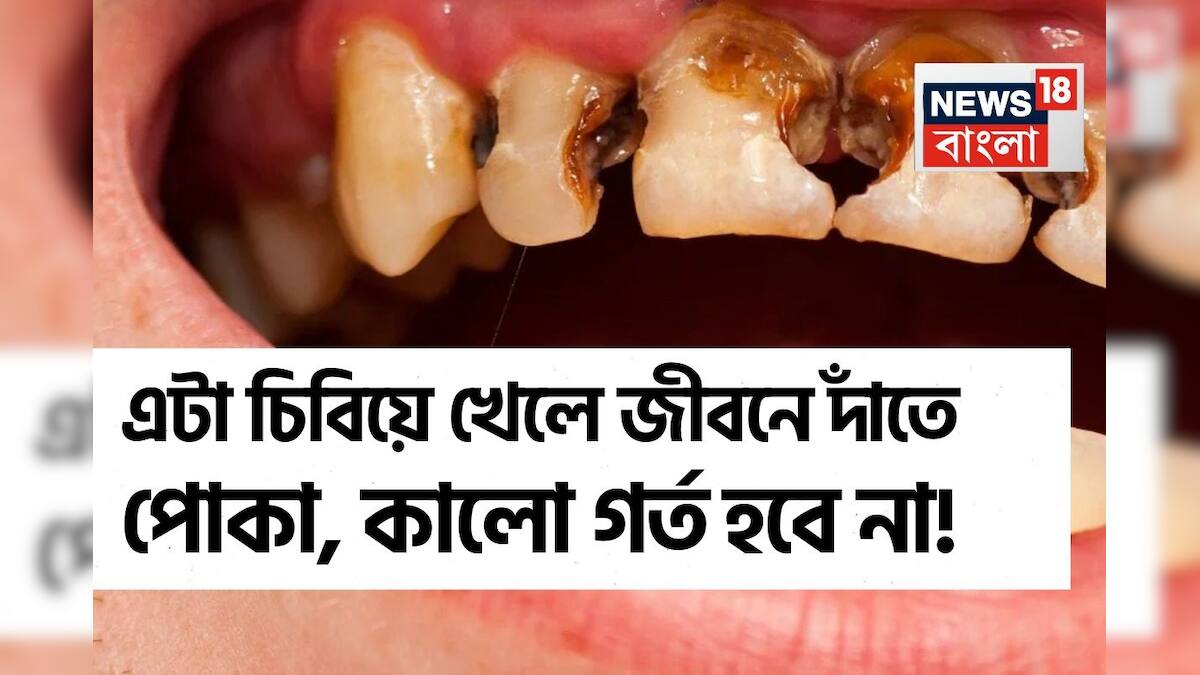 Tooth Cavity: গোল্লায় যাক দামি টুথপেস্ট-মাউথওয়াশ! খাওয়ার পর ‘এটা ...