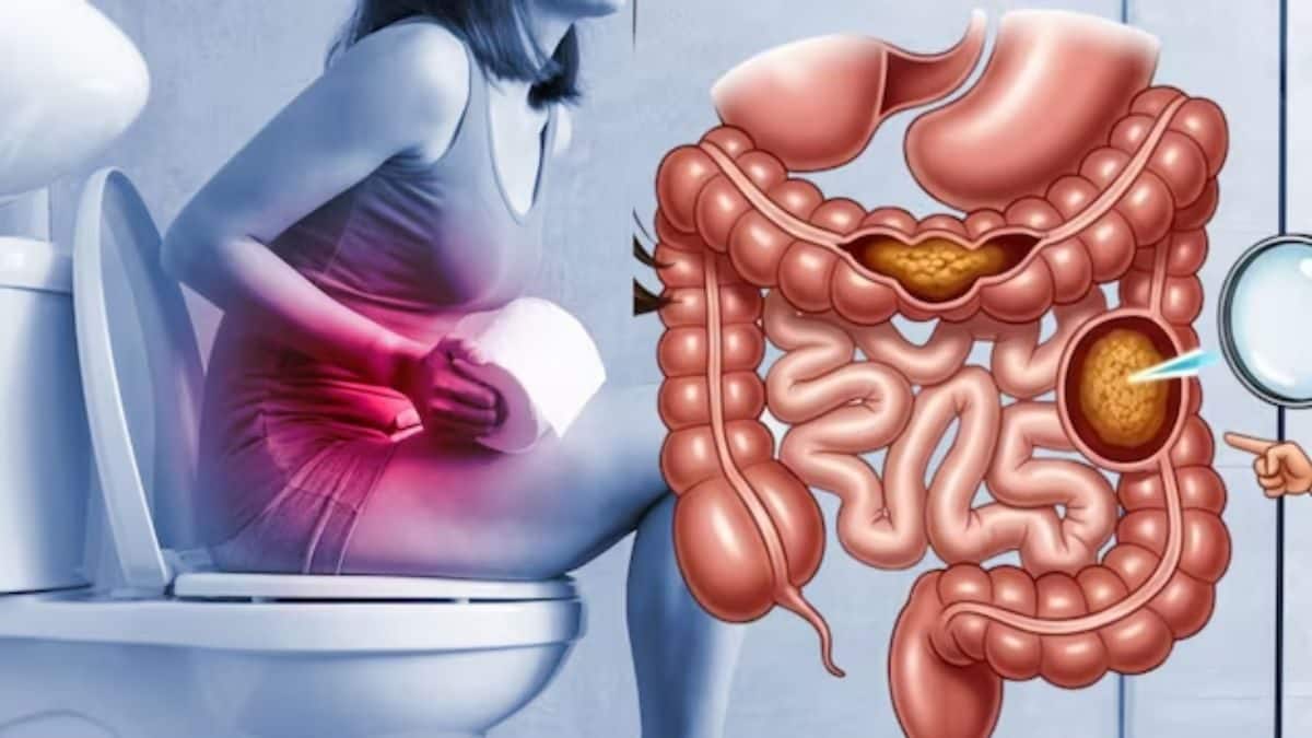 Stomach Clear Home Remedies: দিনের পর দিন পেট পরিষ্কার হচ্ছে না! অতি ...