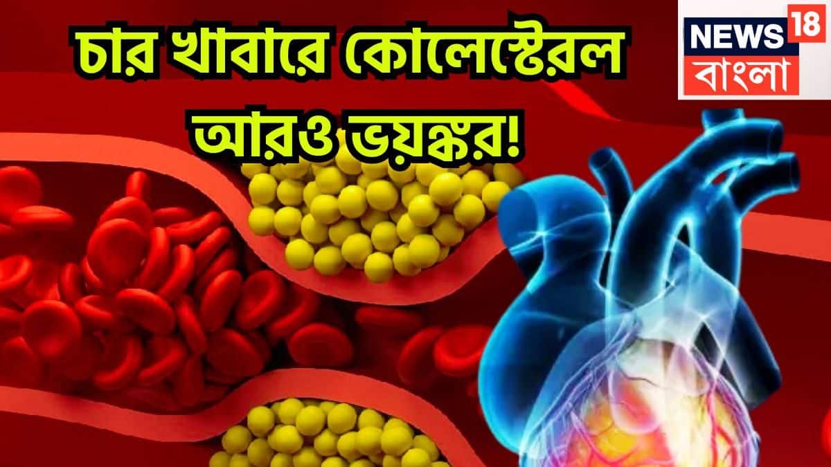 High Cholesterol Control Tips: এই চারটি খাবার জীবন থেকে মুছে ফেলতে হবে ...