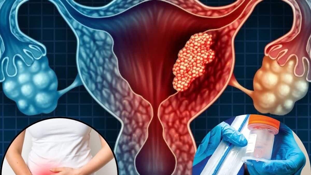 Cancer: শুধু পিরিয়ডস শেষে করুন ‘এটা’...মারণ সারভাইক্যাল ক্যানসার হবে ...