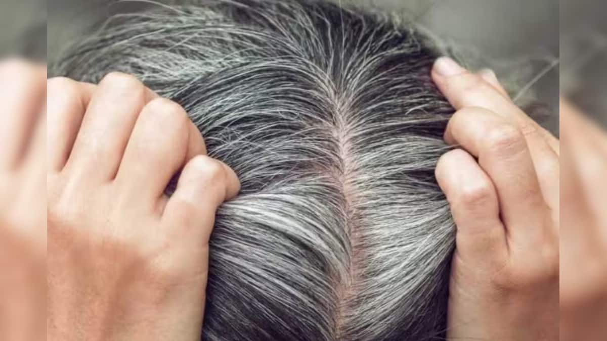 White Hair Colouring Tips: অল্প বয়সে চুল পেকে যাচ্ছে...! দামি হেয়ার ...