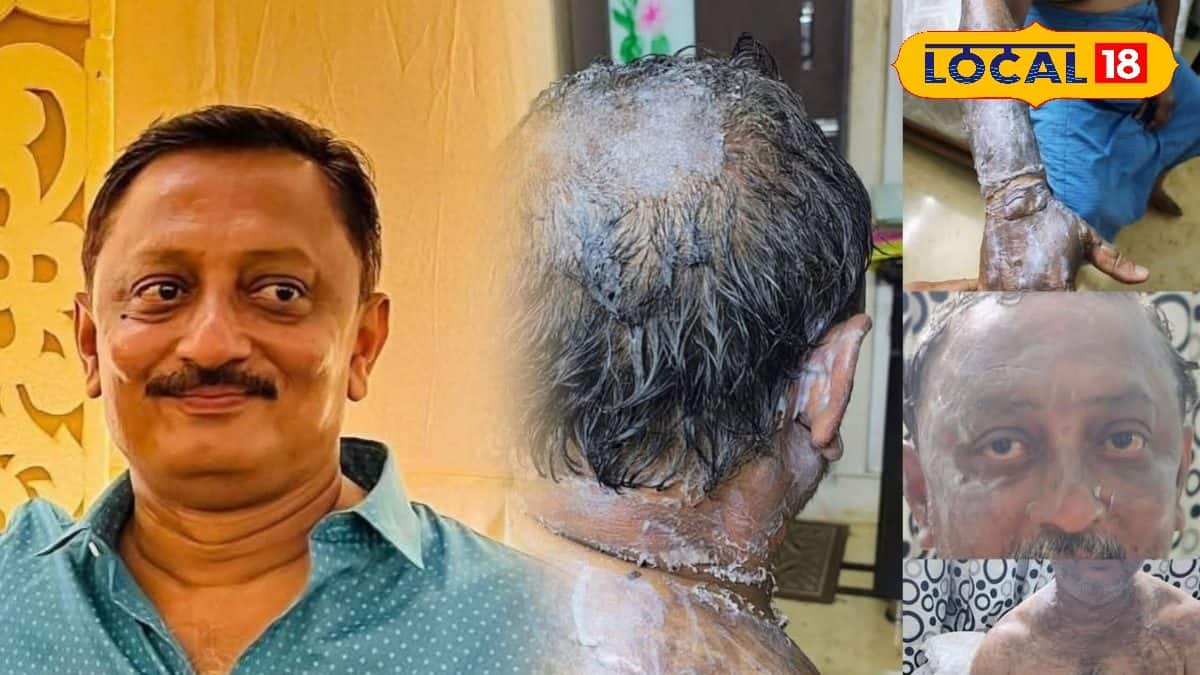 Madhyamgram News মধ্যমগ্রামে ভয়াবহ আগুন, অনেককে বাঁচিয়ে নিজেই ...