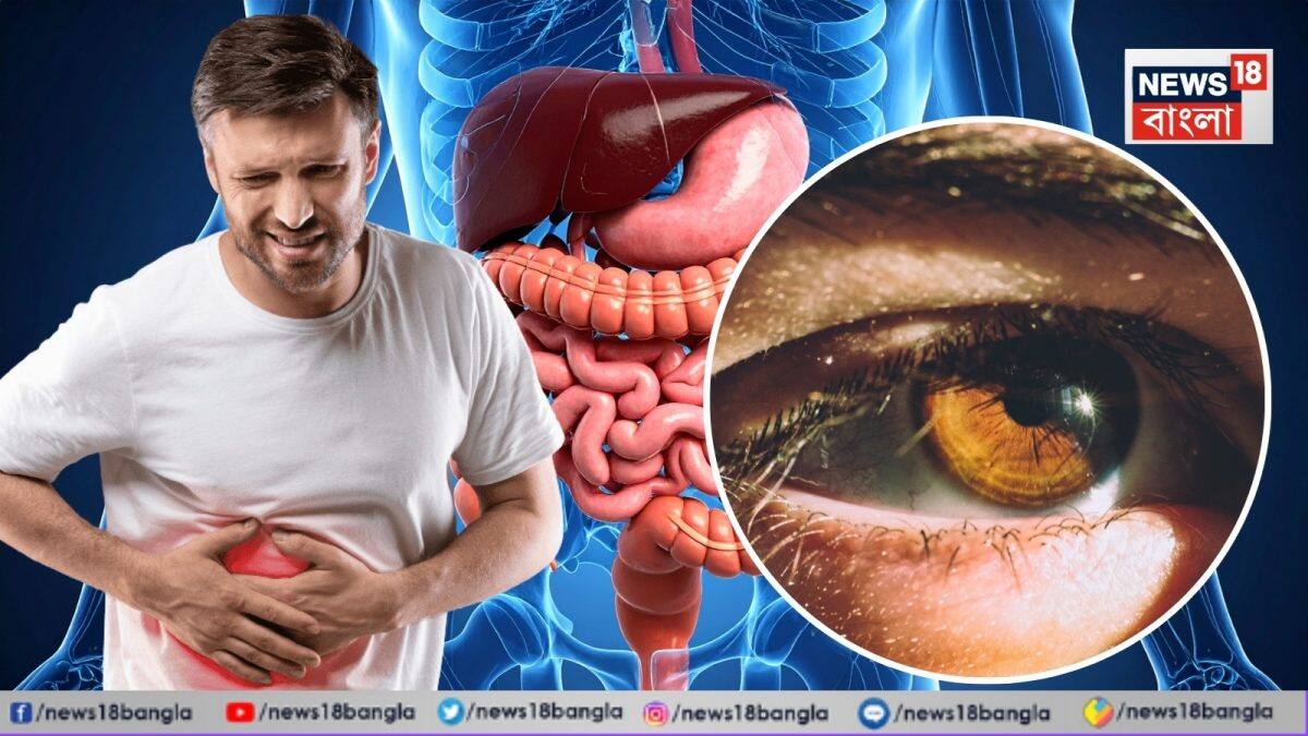 Liver Disease Symptoms: যদি চোখে 'এই' লক্ষণ দেখেন, এটা কিন্তু লিভার ...