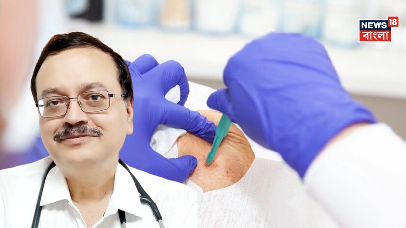 Cancer: বায়োপসি করলে কি ক্যানসার বাড়ে, বেশি ছড়ায় ? সত্যিটা সামনে ...