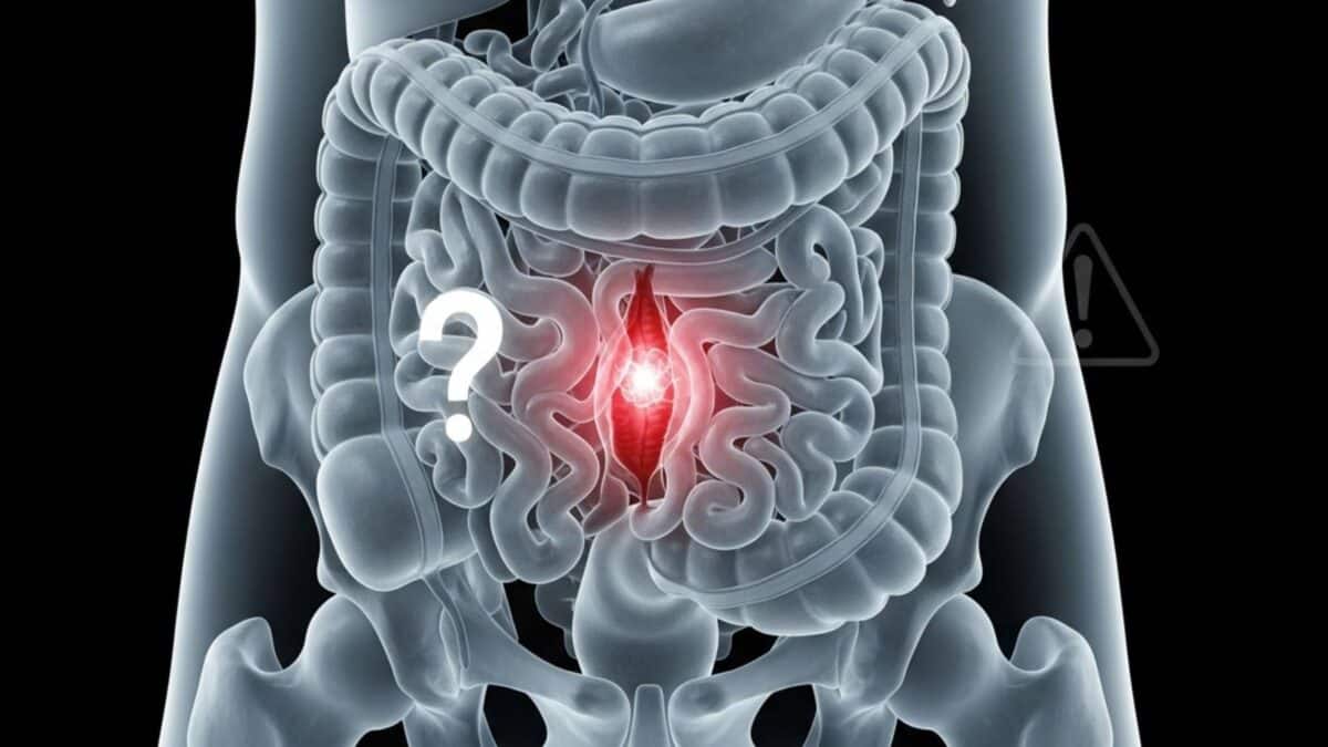 Appendix Cancer Symptoms: আজন্ম অকেজো অদরকারি অঙ্গ অ্যাপেন্ডিক্সেও হয় ...
