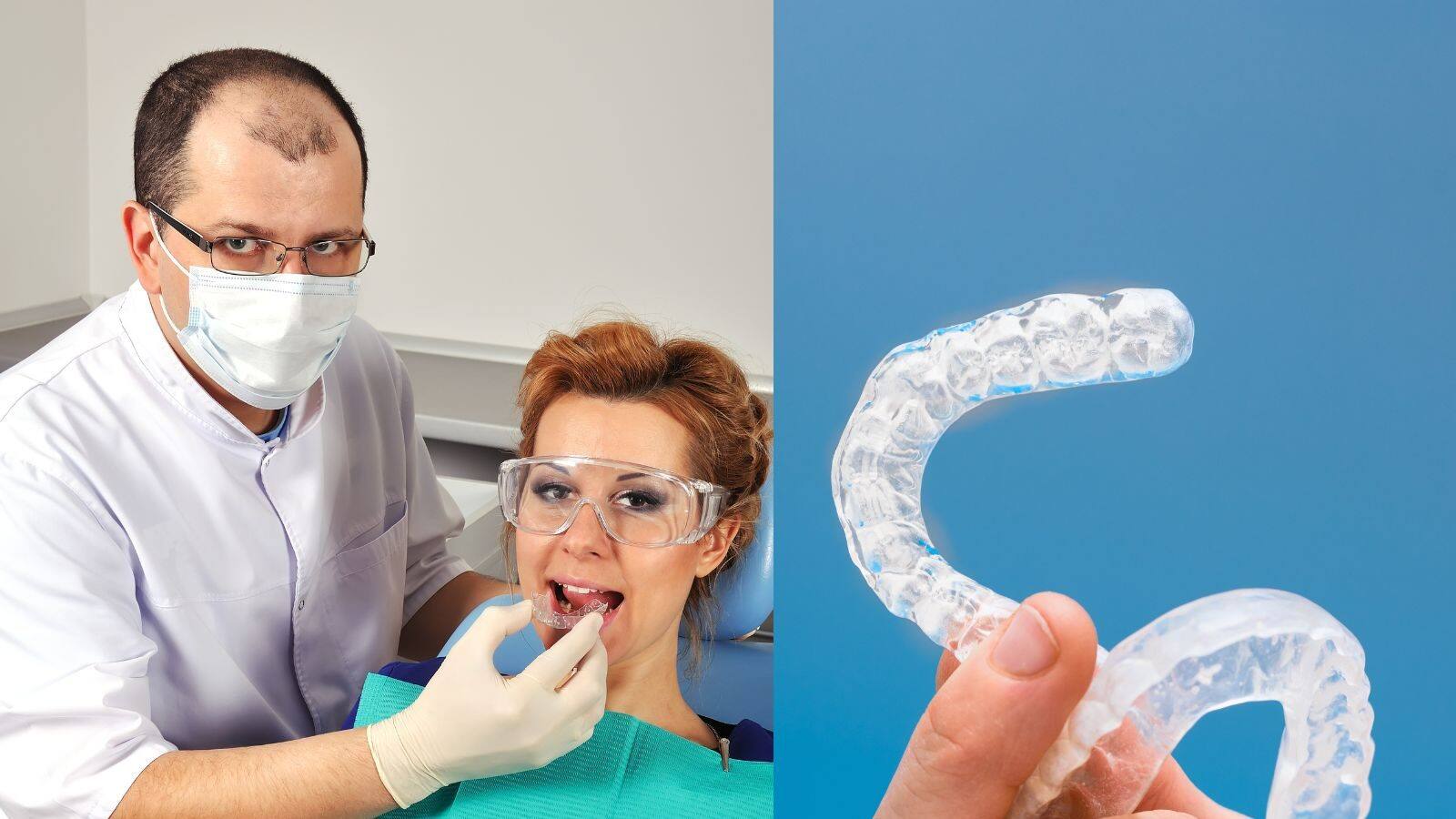 Dental splinting technique gujarati gh rv - શું તમે જાણો છો તમારા ...