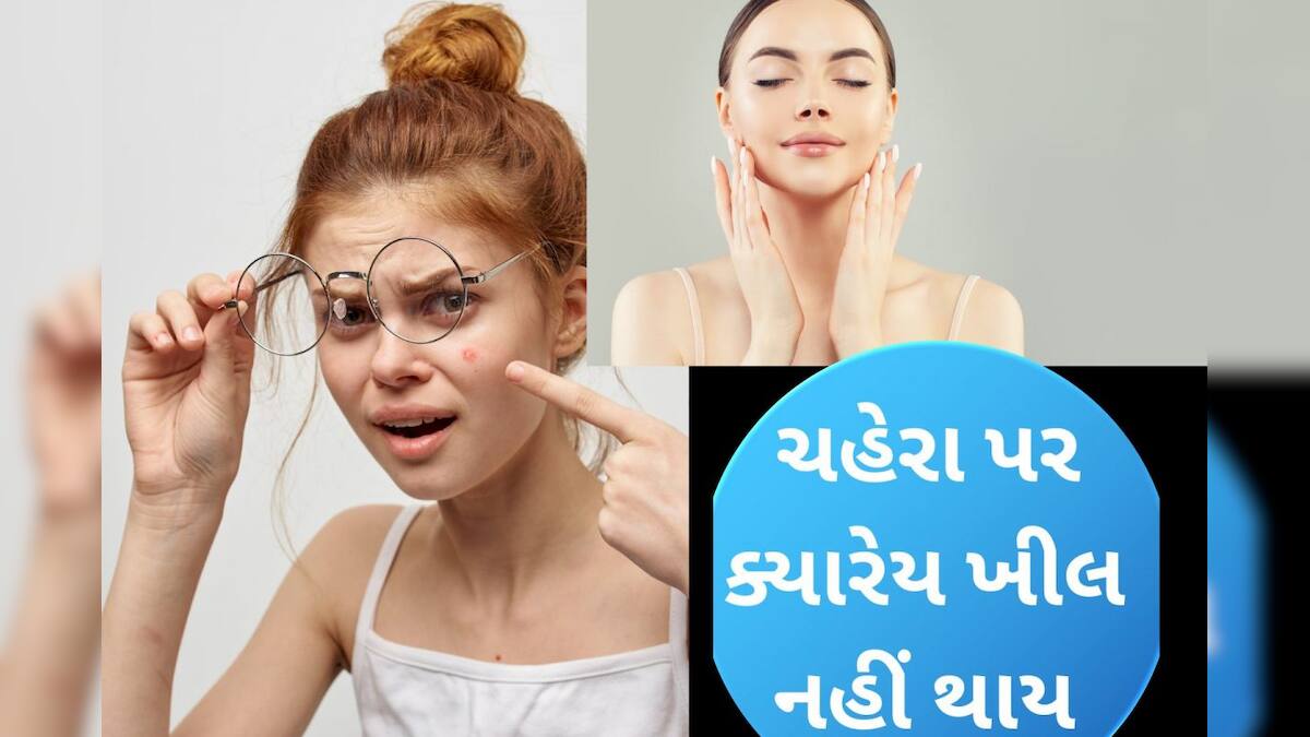 હંમેશા માટે Pimples ને BYE-BYE કહી દો, મુલતાની માટીમાં આ વસ્તુ મિક્સ ...