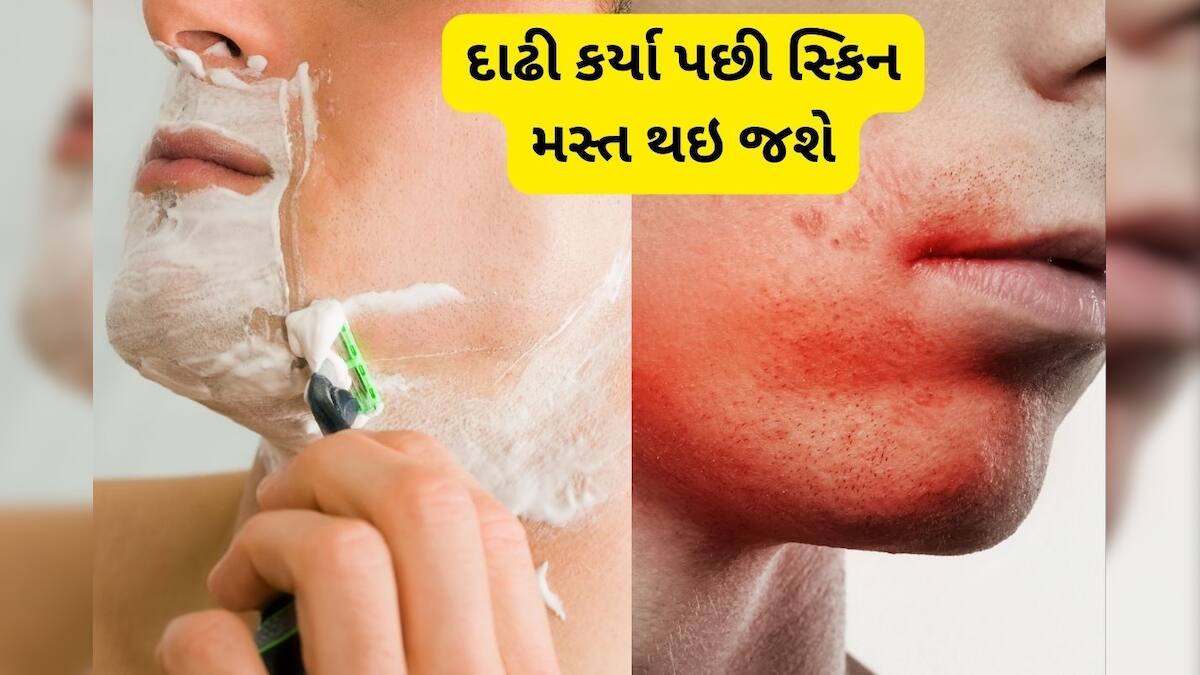 Shaving side effects in winter season - શેવિંગ કર્યા પછી સ્કિન ડ્રાય થઇ ...