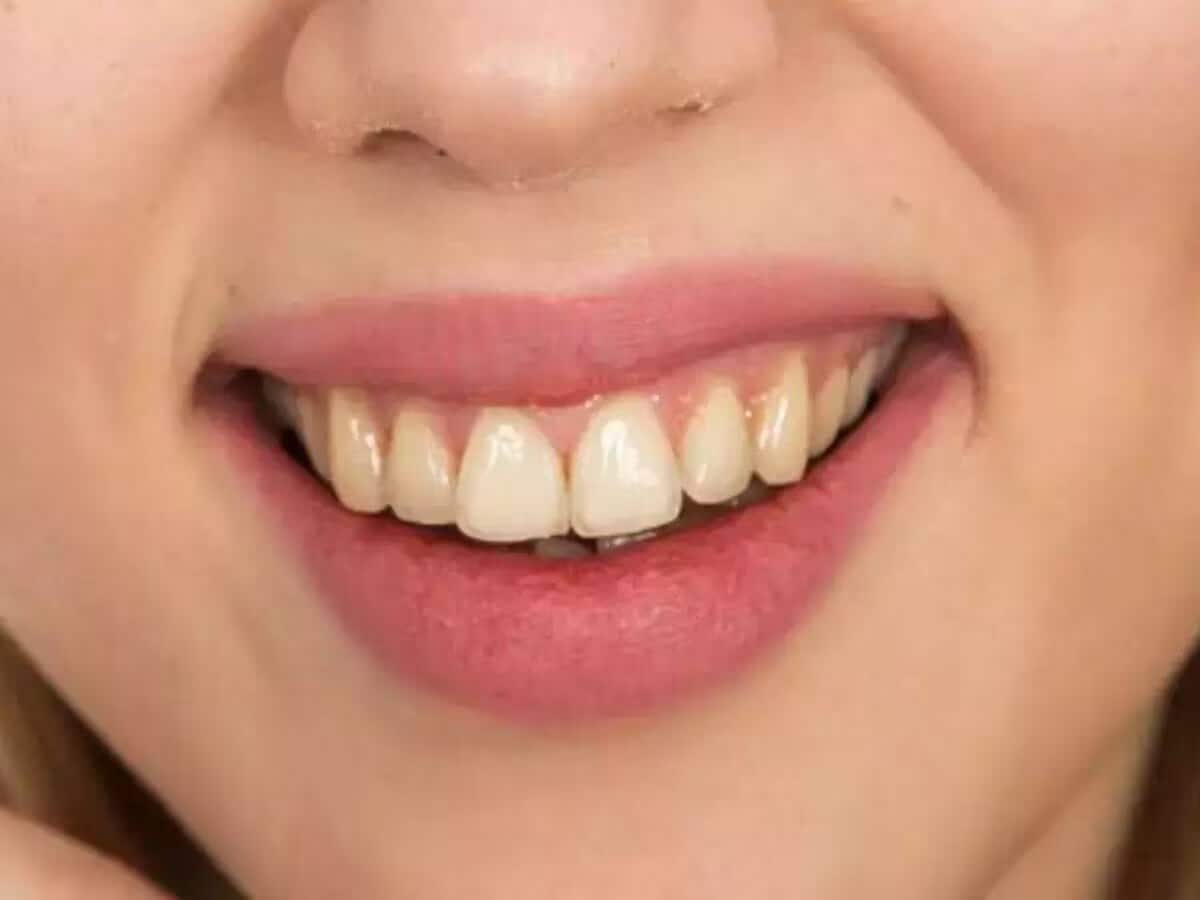 Pyria Teeth Solution: મોઢું ગંધાઈ રહ્યું છે? દાંતમા દુખાવો થઈ રહ્યો છે ...