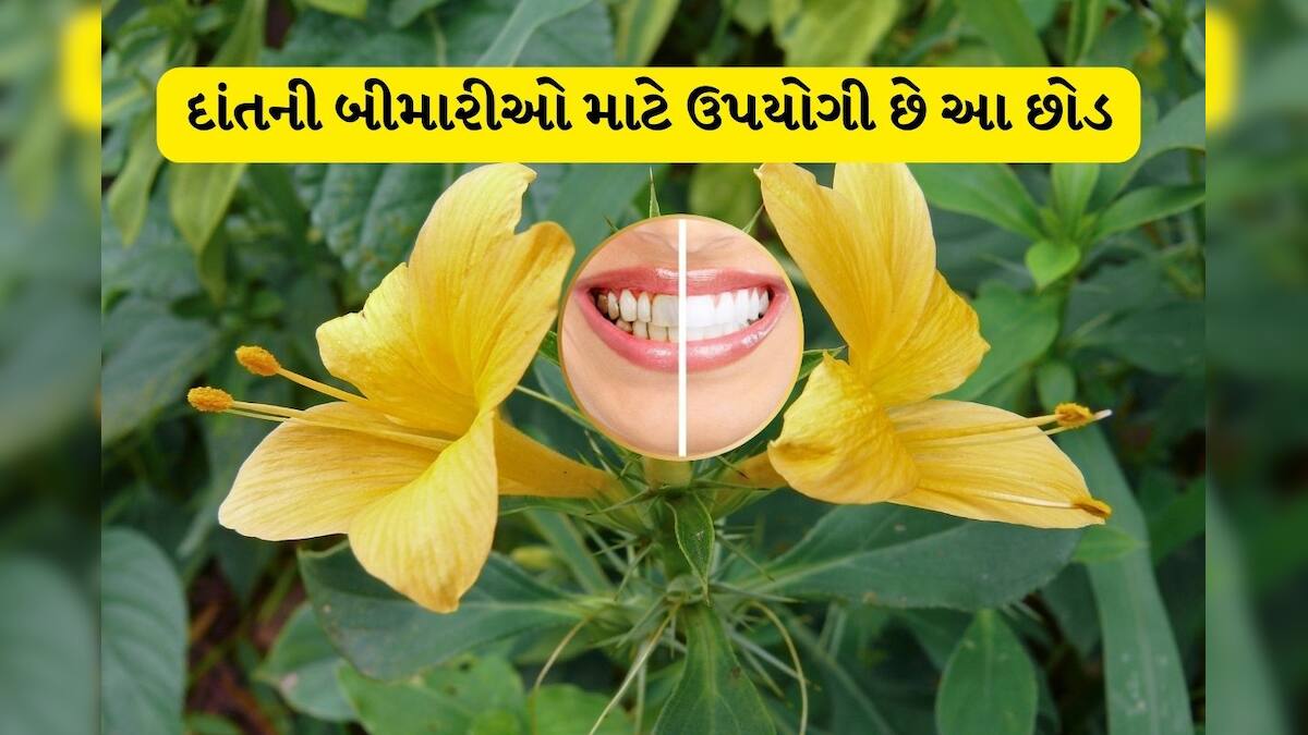 દાંતની તમામ પ્રકારની બીમારી અને પીળાશને એક ઝાટકે દૂર કરી દેશે આ ઝાડ ...