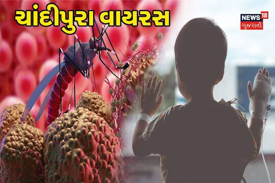 બાળકોનો કાળ ચાંદીપુરા વાયરસ ક્યાંથી આવ્યો? જાણો ડોક્ટર પાસેથી તમારા ...