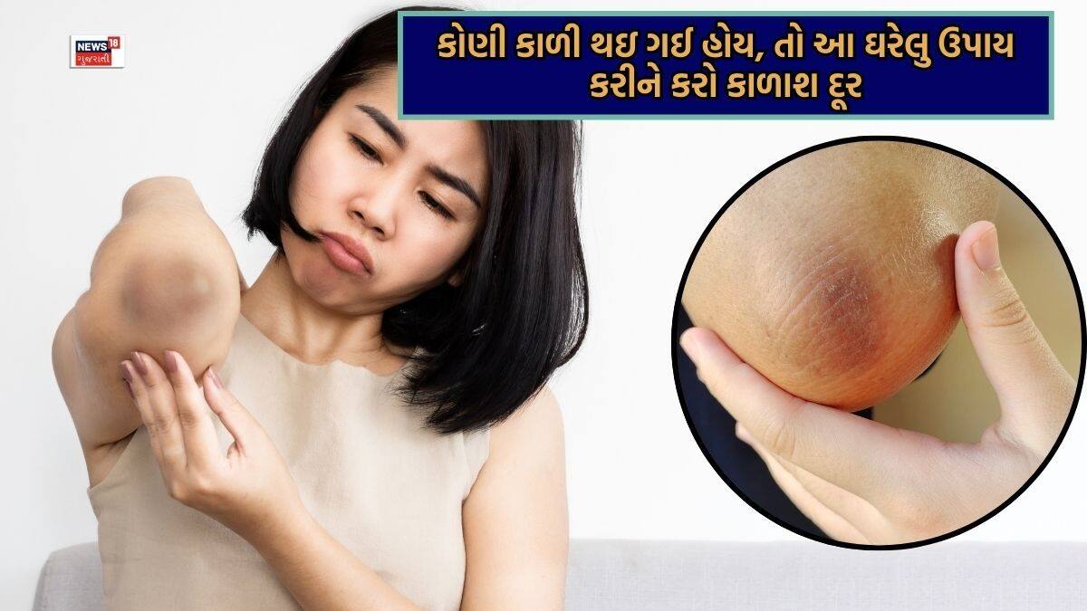 home remedies for dark elbows - કોણી બહુ કાળી થઇ ગઇ છે? આ દેશી નુસખો ...