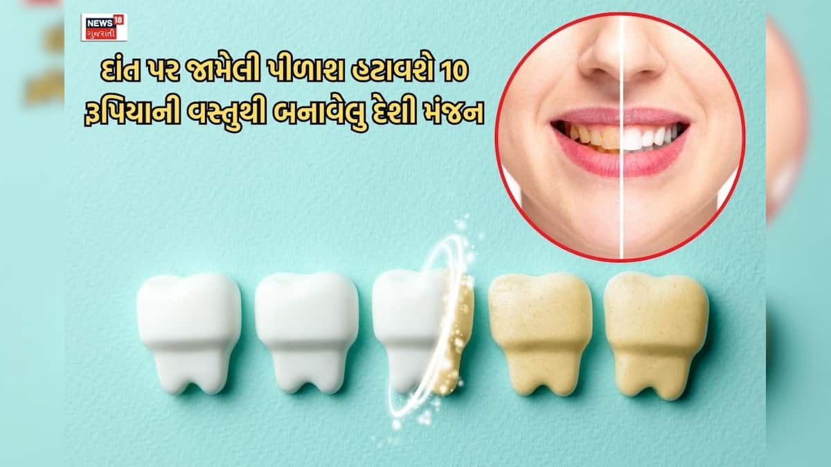how to use phitkari for teeth whitening - પીળા દાંત દૂધ જેવા સફેદ થઇ ...