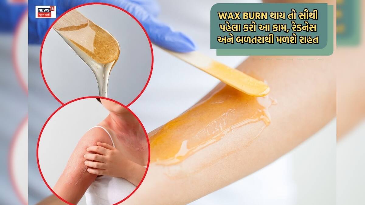 What to do first if your skin gets burnt due to waxing - વેક્સ કરાવતી ...