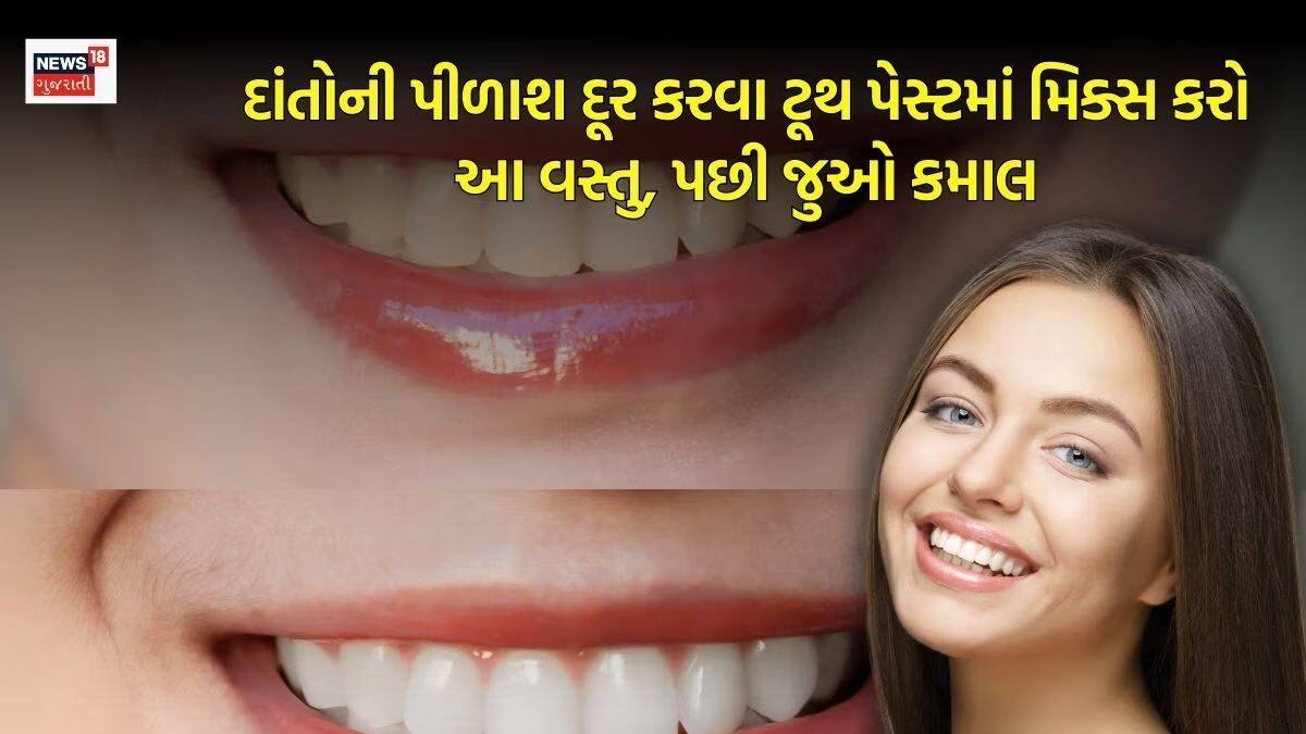 How to remove yellow layer on teeth get white and shiny teeth - દાંત પર ...