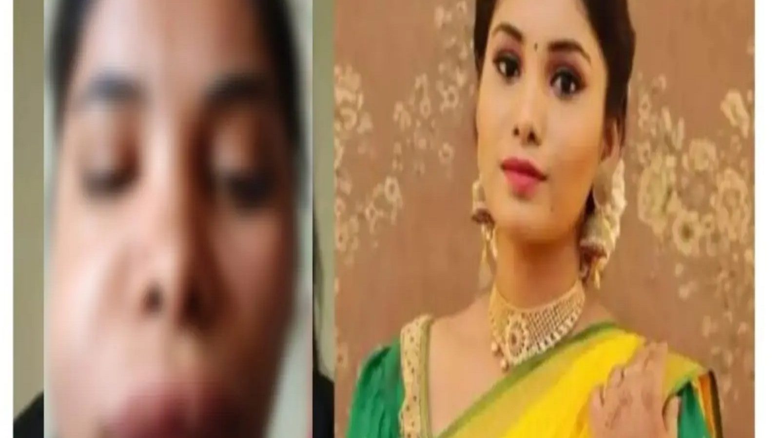 Swati Sathish Surgery:کنڑ ایکٹریس سواتی ستیش کو سرجری کرانا پڑا مہنگا ...