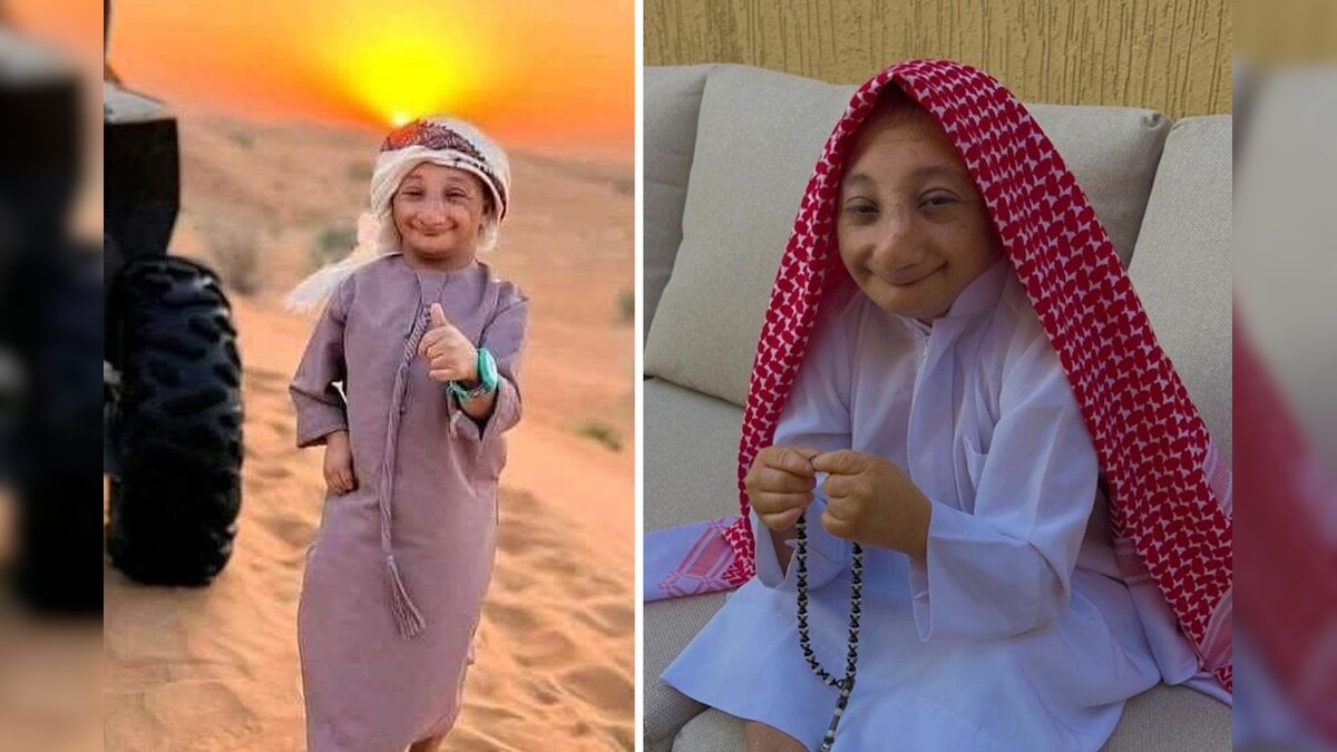 سعودی عرب کے پستہ قد سوشل میڈیا اسٹار عزیز الاحمد کا 27 سال کی عمر میں ...