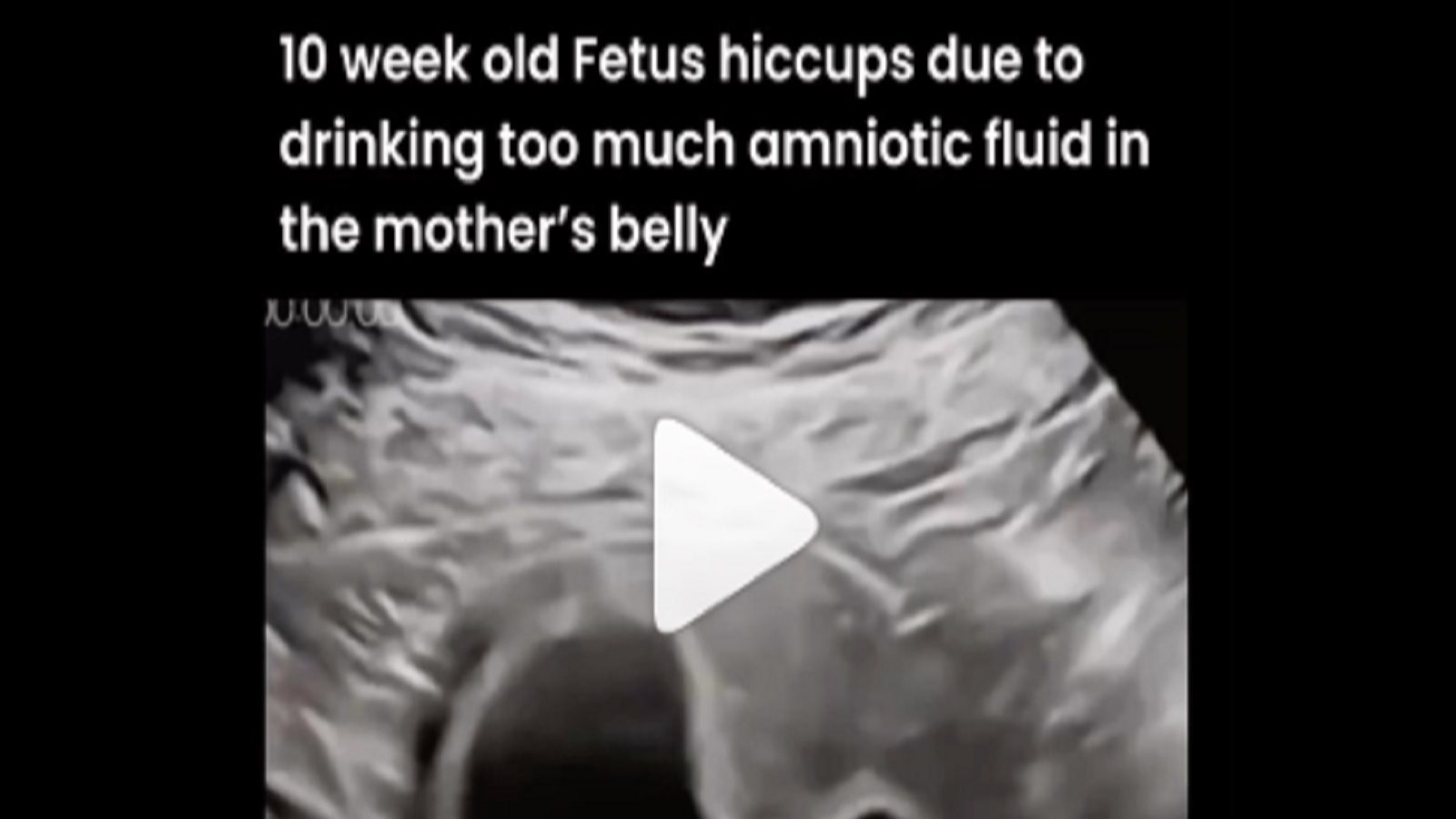 Viral video 10 weeks fetus hiccups video in mother womb video goes ...