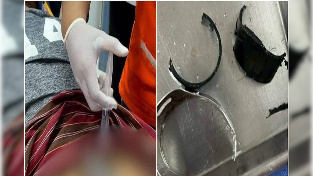 Viral thailand man locked private part due to fear of theft man wearing ...