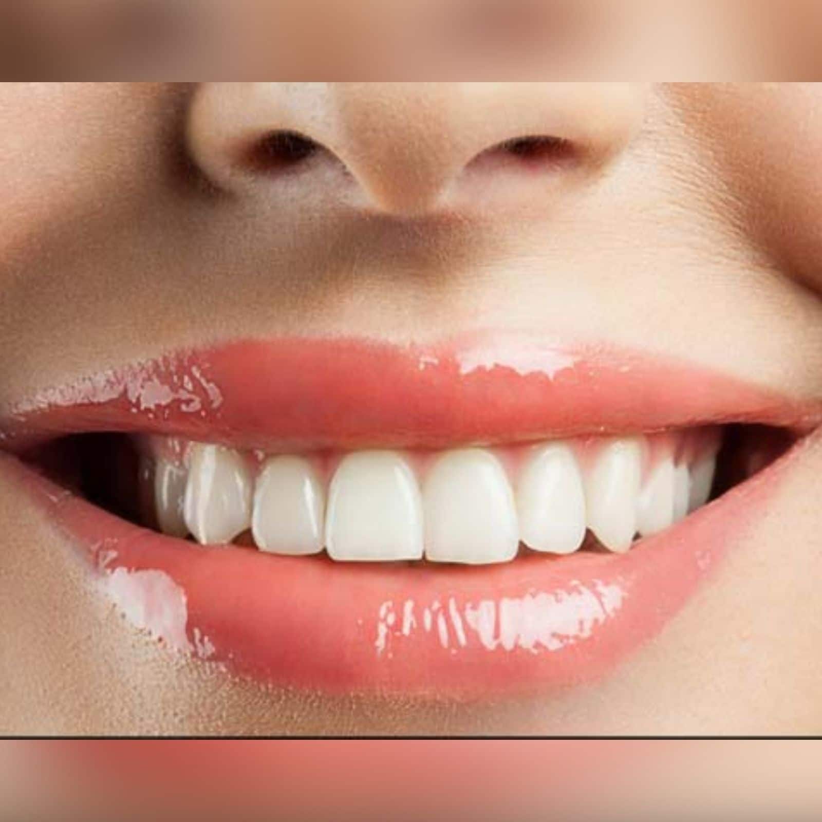 உங்கள் பற்களை எப்போதும் சுத்தமாக வைத்துக்கொள்ள 2 உணவுகள் – News18 தமிழ்