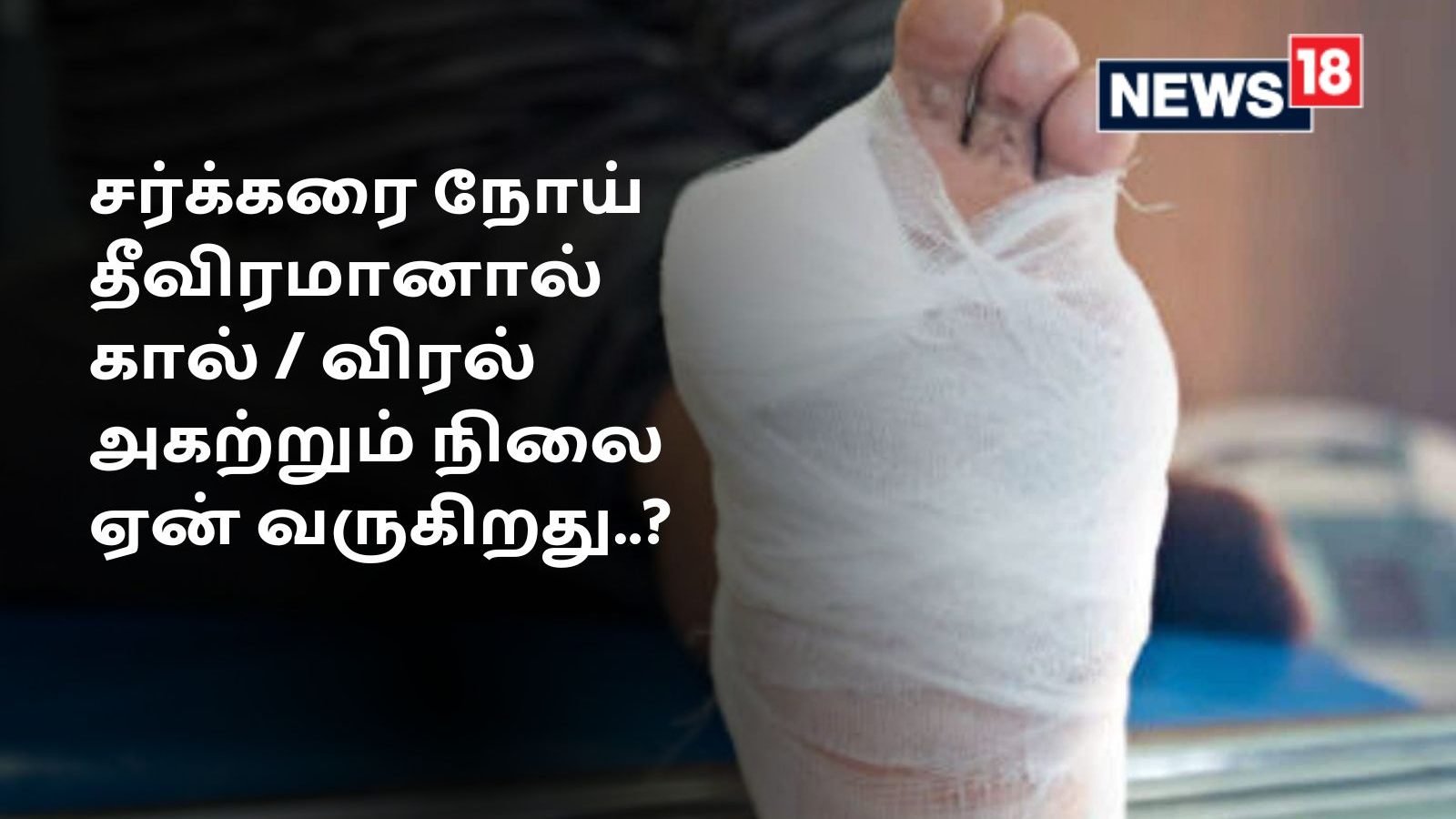 Diabetes and Amputation Why Its Done and How to Prevent It | Amputation ...