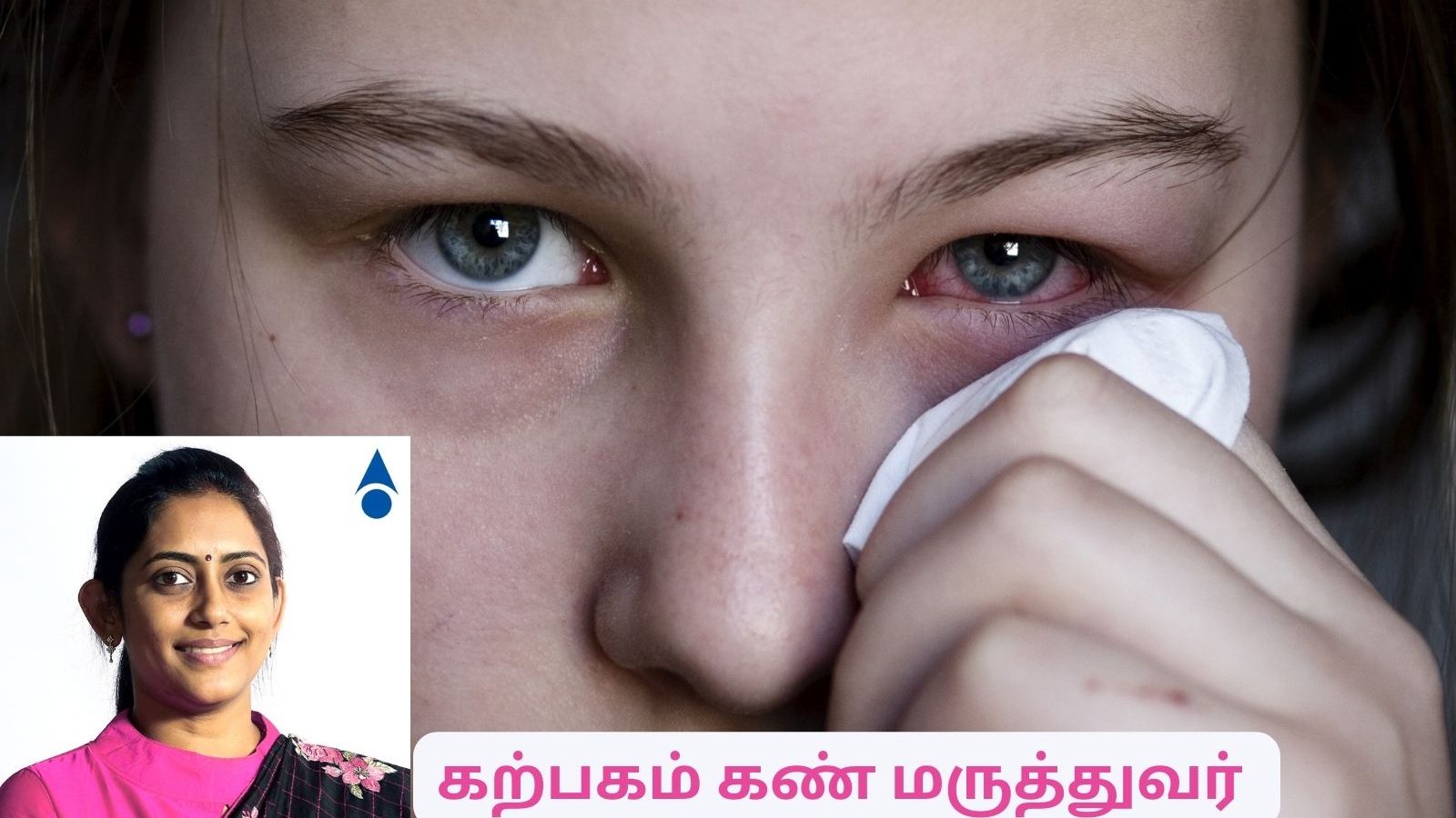 சென்னையில் அதிகரித்து வரும் ‘மெட்ராஸ் ஐ’... சுய மருத்துவம் வேண்டாம் என ...