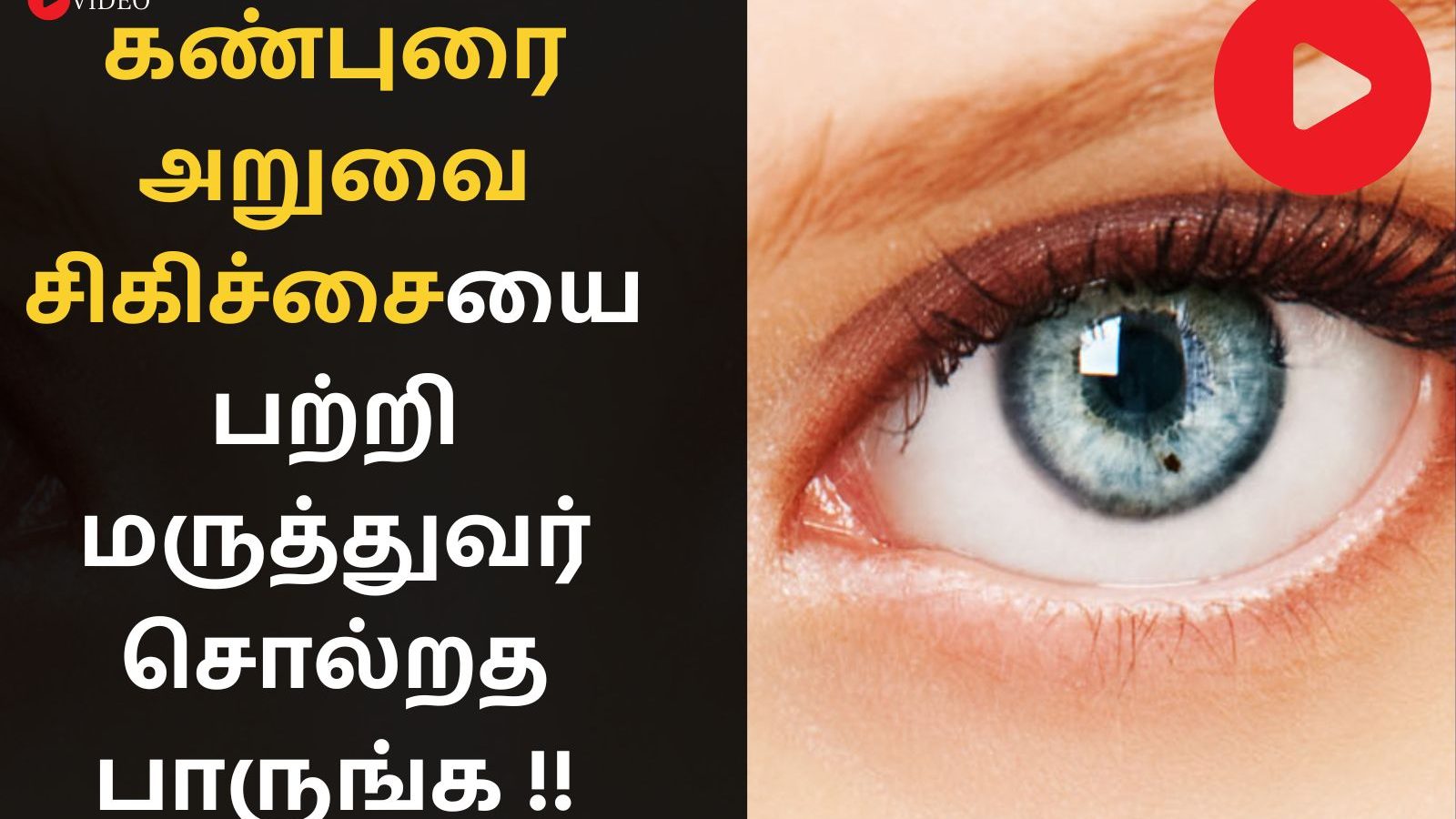 கண்புரை அறுவை சிகிச்சையை தாமத்திக்காதீங்க... மருத்துவரின் அட்வைஸ் ...