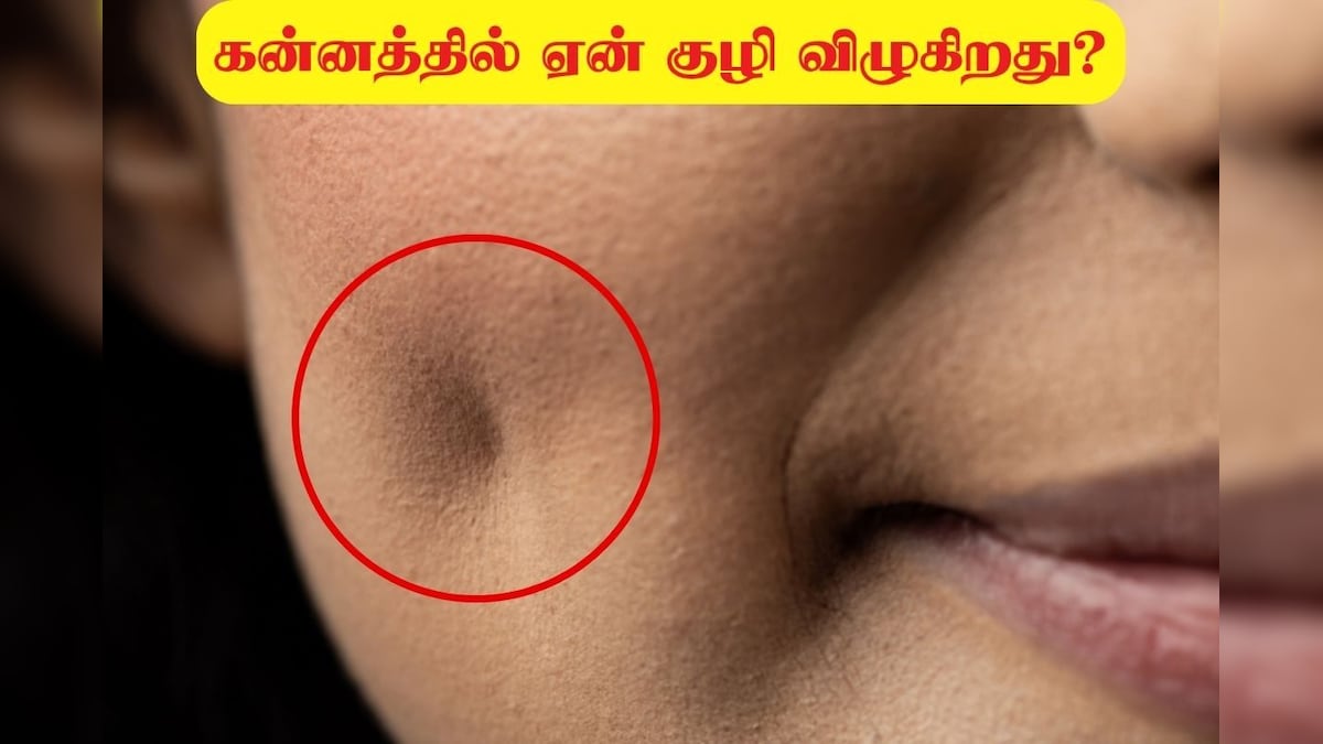 Dimple: சிரிக்கும்போது கன்னத்தில் குழி விழுகிறதா? இதற்கு காரணம் என்ன ...