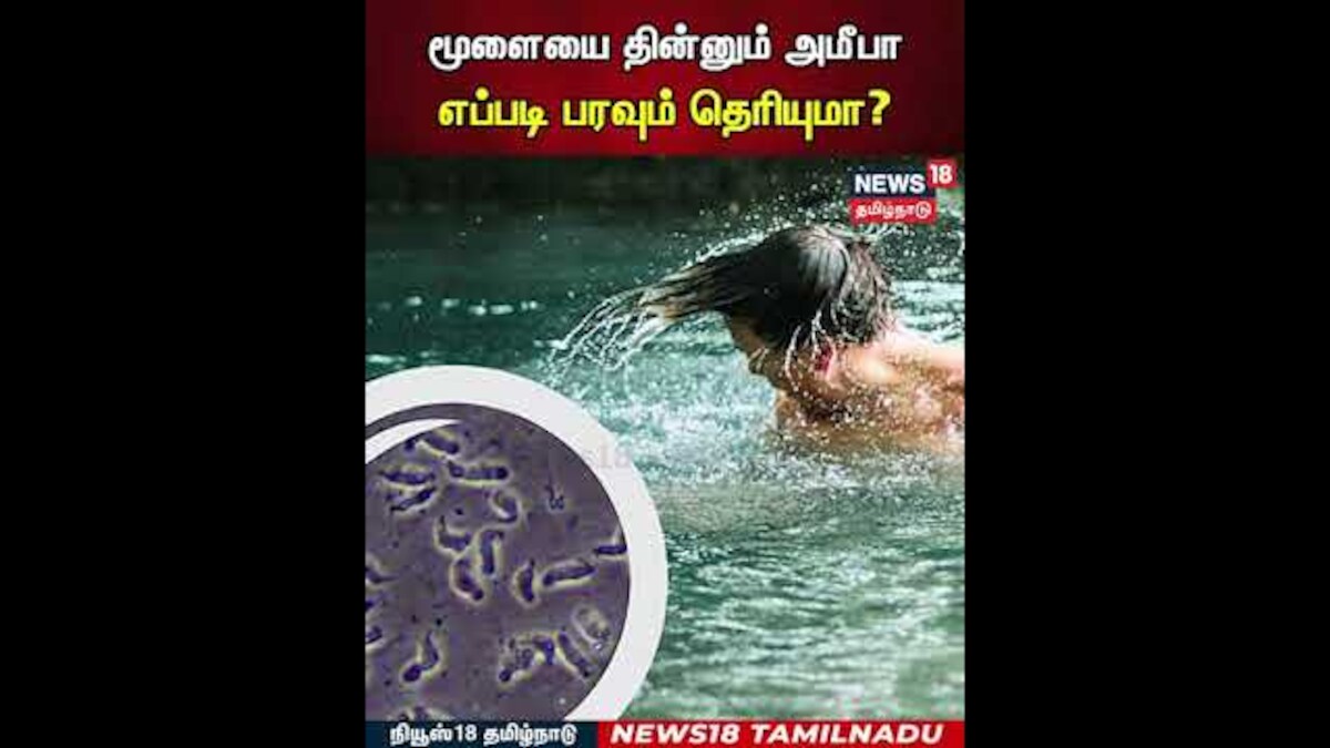 Amoeba Infection | மூளையை தின்னும் அமீபா...எப்படி பரவும் தெரியுமா ...
