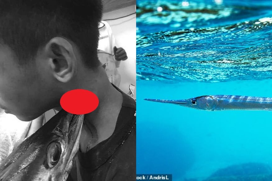 పిల్లాడి మెడలో గుచ్చుకున్న చేప... షాకింగ్ సీన్... | Indonesian ...