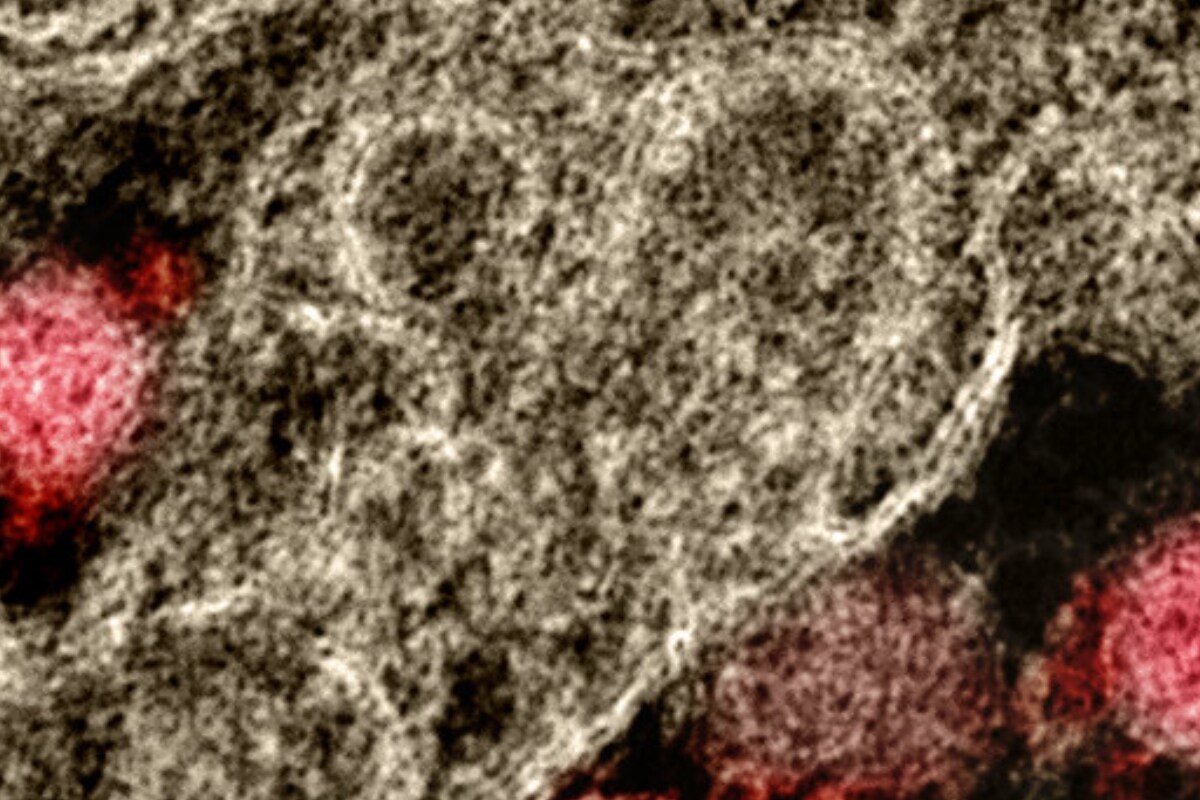 News18 Telugu - ప్రపంచానికి అలర్ట్... కరోనా లాంటి మరో క్రిమి... మెదడును ...