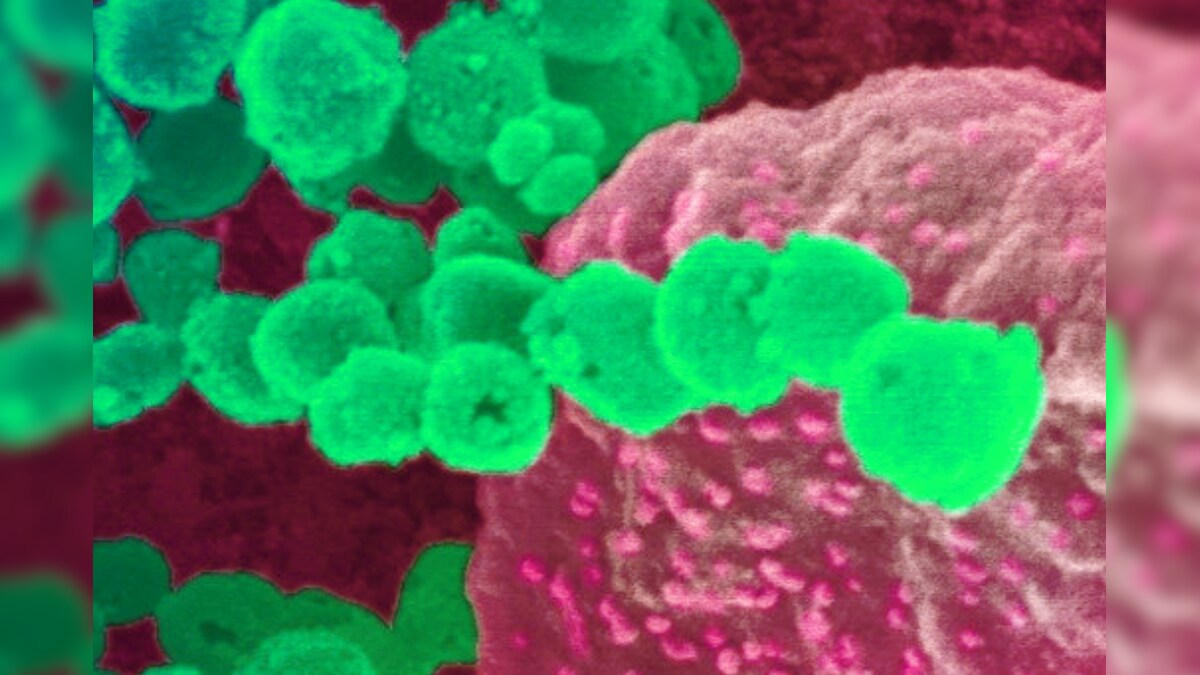 Green Fungus: వామ్మో.. గ్రీన్ ఫంగస్ కూడా వచ్చేసింది.. ఈ వ్యాధి ...