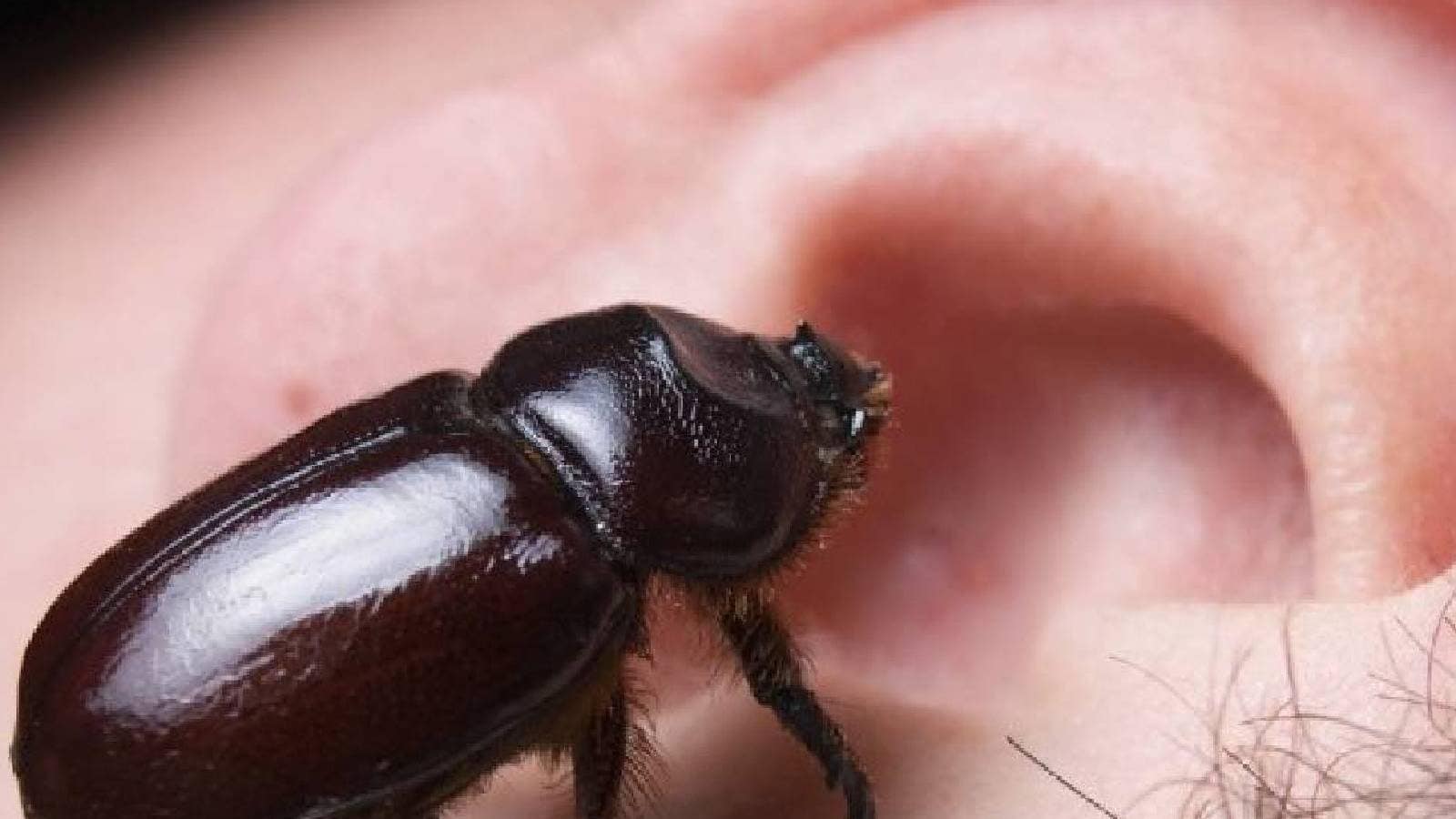 How To Remove An Insect From The Ear