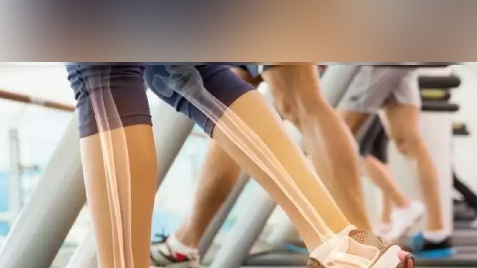 Bones health: ఎముకలు ఆరోగ్యంగా ఉండాలంటే ఈ 5 ఆహారాలకు నో చెప్పండి..!/Say ...