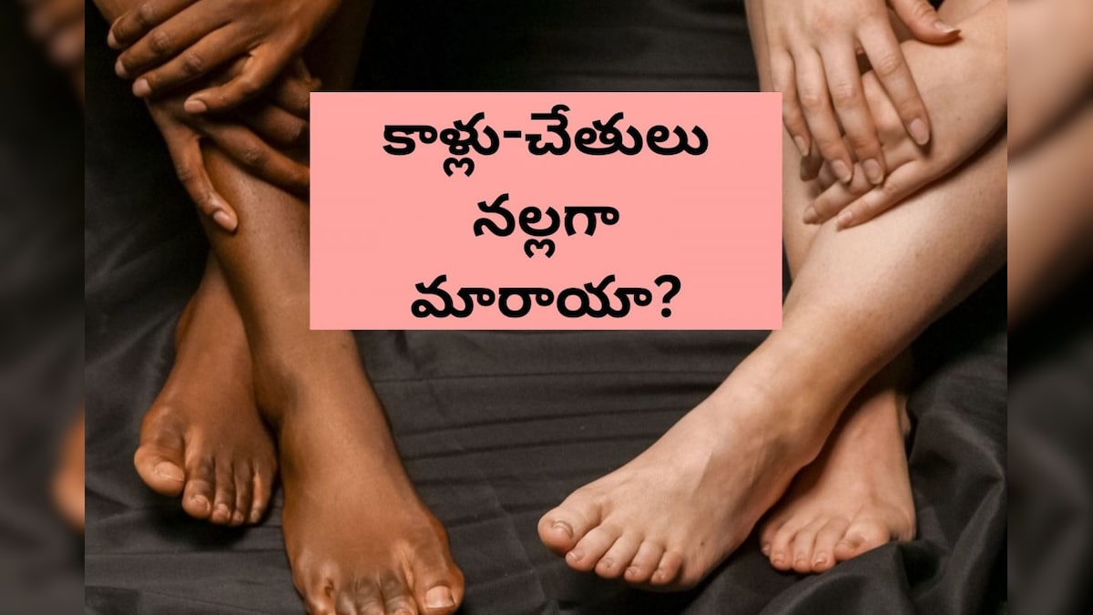 Hand and Leg Blackness: చేతులు, కాళ్లు నల్లగా మారాయా? ఈ సత్వర రెమిడీ ...