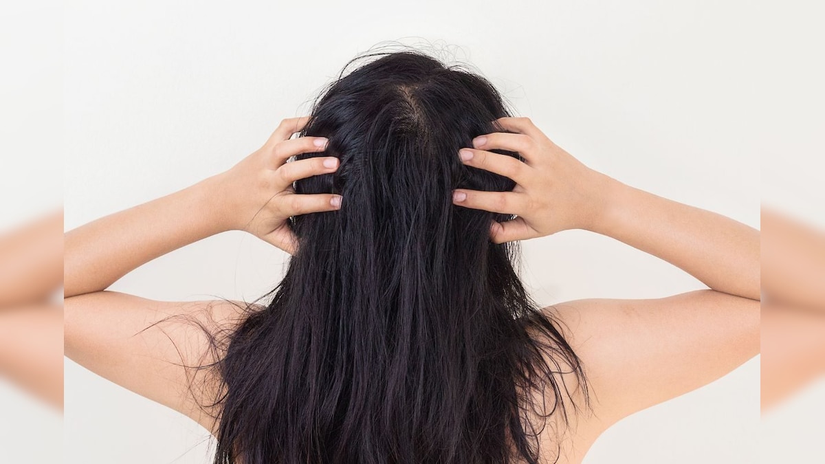 How to get rid of hair itching problems – Hair Tips: తలలో బాగా దురదగా ...