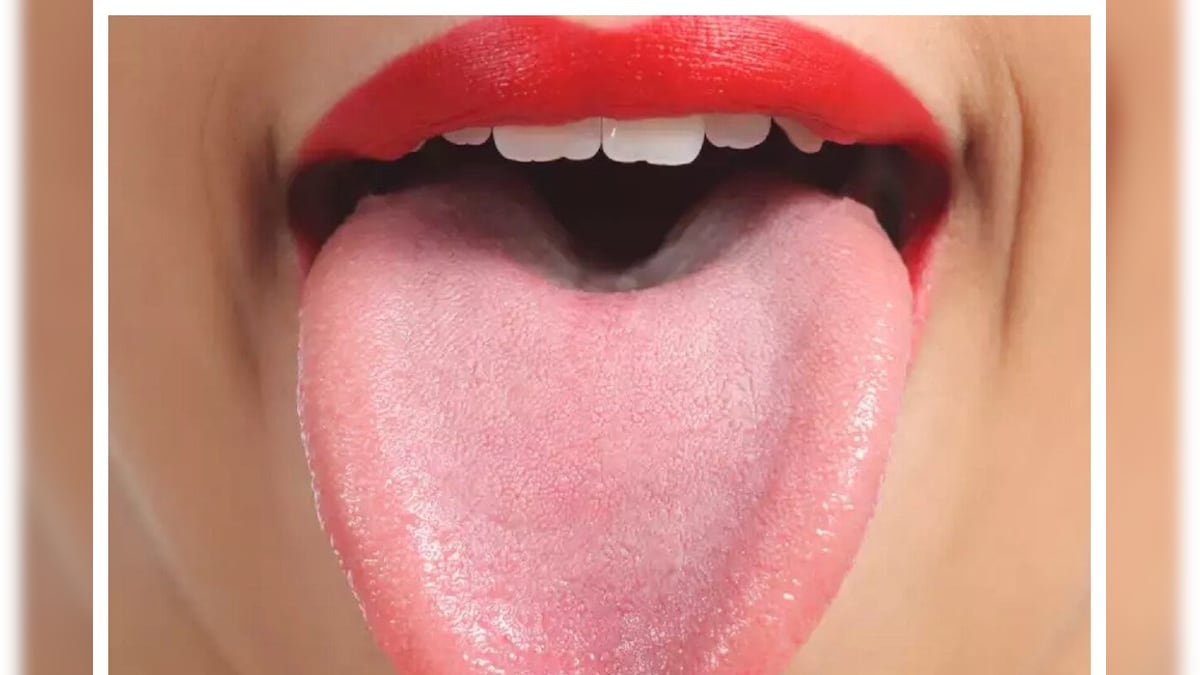 Burnt Tongue: వేడివేడిగా ఏదైనా తింటే నాలుక కాలిందా..? రిలీఫ్ కోసం ఈ ...