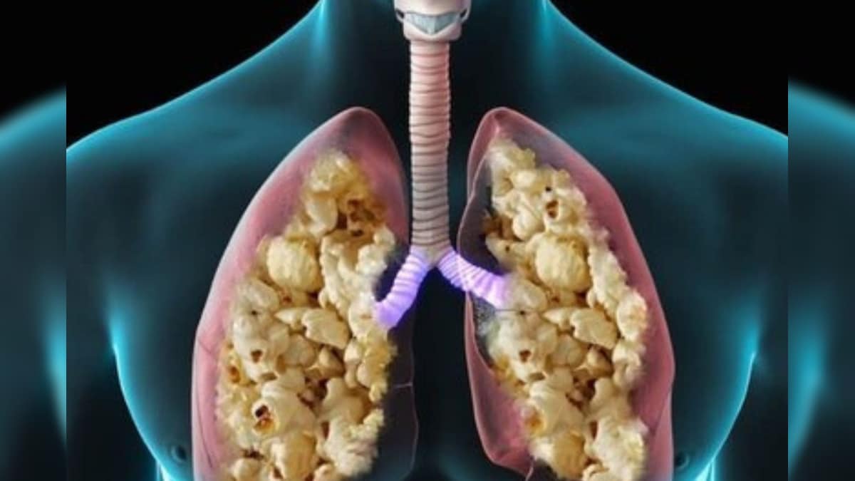 Popcorn Lung Signs: కఫం లేకుండా దగ్గు వస్తోందా? ఈ వ్యాధికి సంకేతం ...