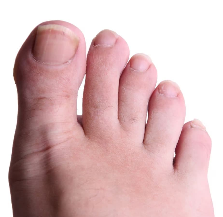 Finger Astrology: కాలి బొటనవేలు కంటే పక్కన వేలు పొడవుగా ఉంటే అర్థం ...