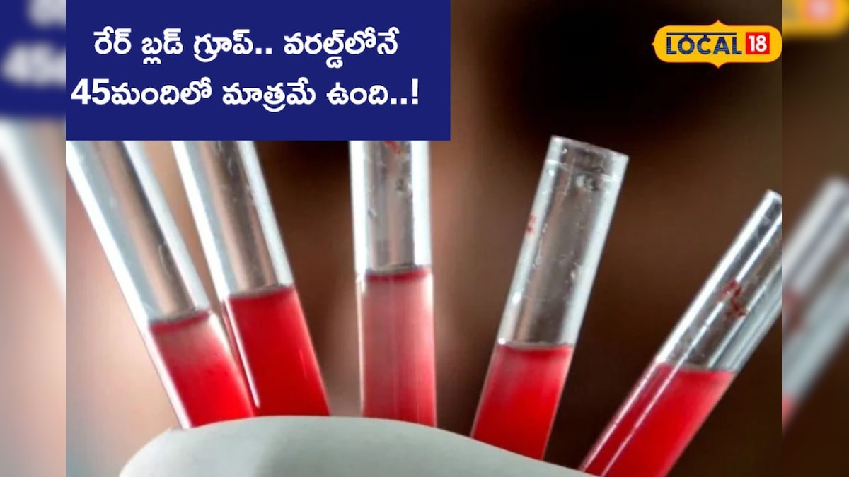 Rare Blood Group: ఈ గ్రూప్ రక్తం పేరే గోల్డ్.. ఎంత డబ్బిచ్చినా దొరకదు ...