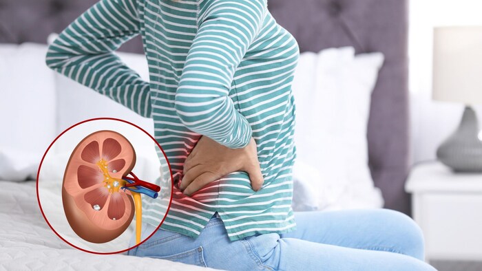 Kidney Health: డైలీ లైఫ్‌లో మీకు ఉండే ఈ 5 అలవాట్లు వెంటనే మానేయకపోతే ...