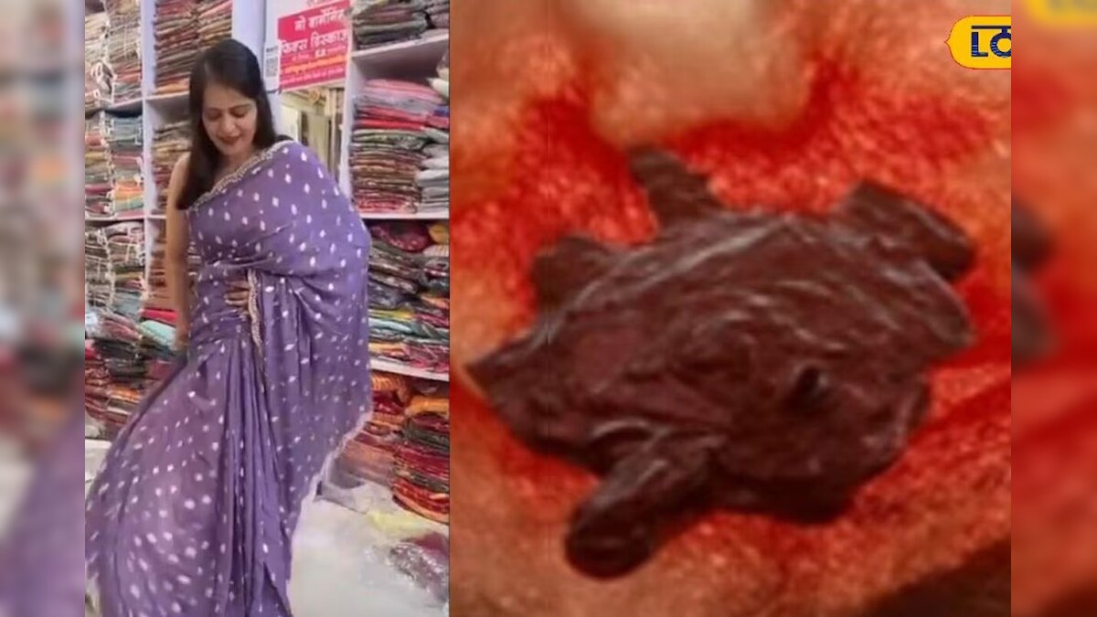 Saree Cancer : చీర కట్టుకోవడం వల్ల క్యాన్సర్ వచ్చే ఛాన్స్! 'సైలెంట్ ...