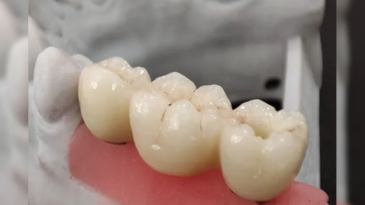 Lab-grown teeth: ల్యాబ్‌లోనే మనిషి దంతాలు పెంచిన శాస్త్రవేత్తలు.. ఇక ...