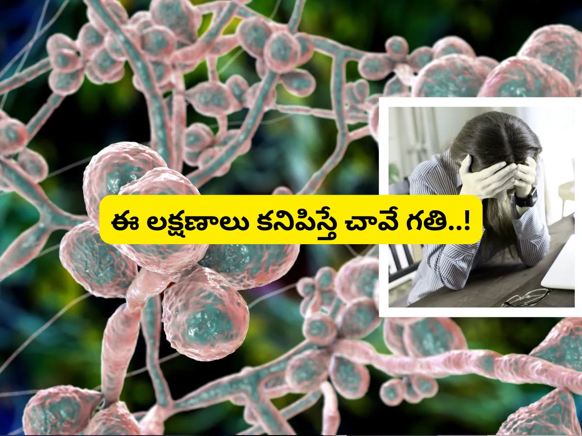 Human Eating Fungus: మానవ శరీరాన్ని తినేస్తున్న ఫంగస్‌.. ఈ లక్షణాలు ...